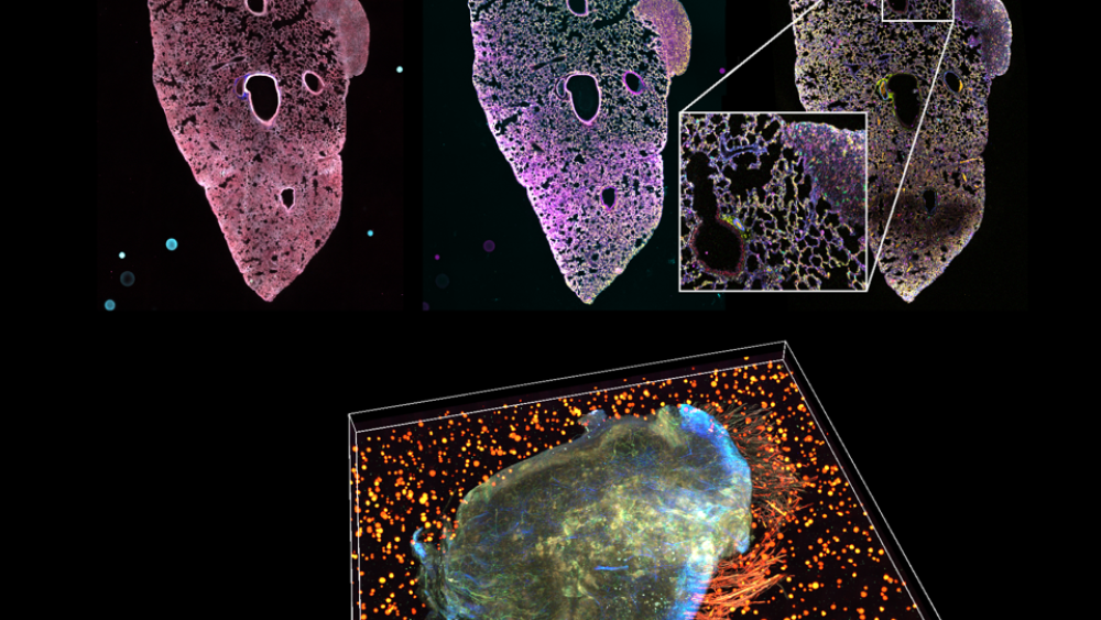 Spatial biology | Cancer Grand Challenges